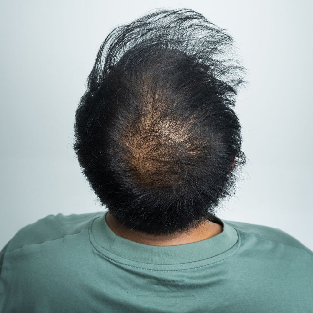 HairBear
