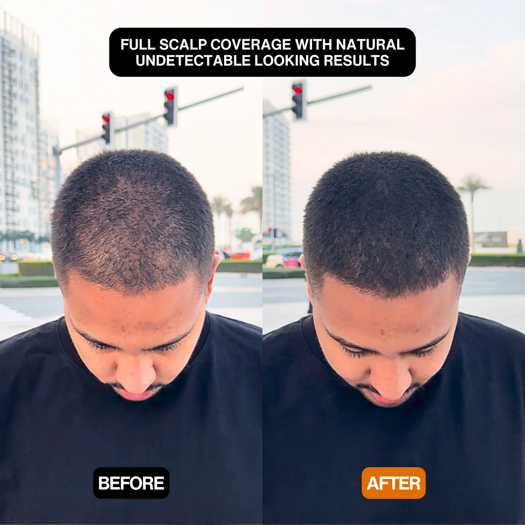 The No.1 Hair Loss Fix - Easy & Instant Results | Hair Filler Powder ...