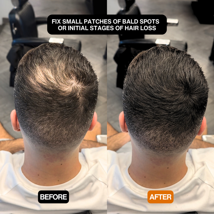 The No.1 Hair Loss Fix - Easy & Instant Results | Hair Filler Powder ...