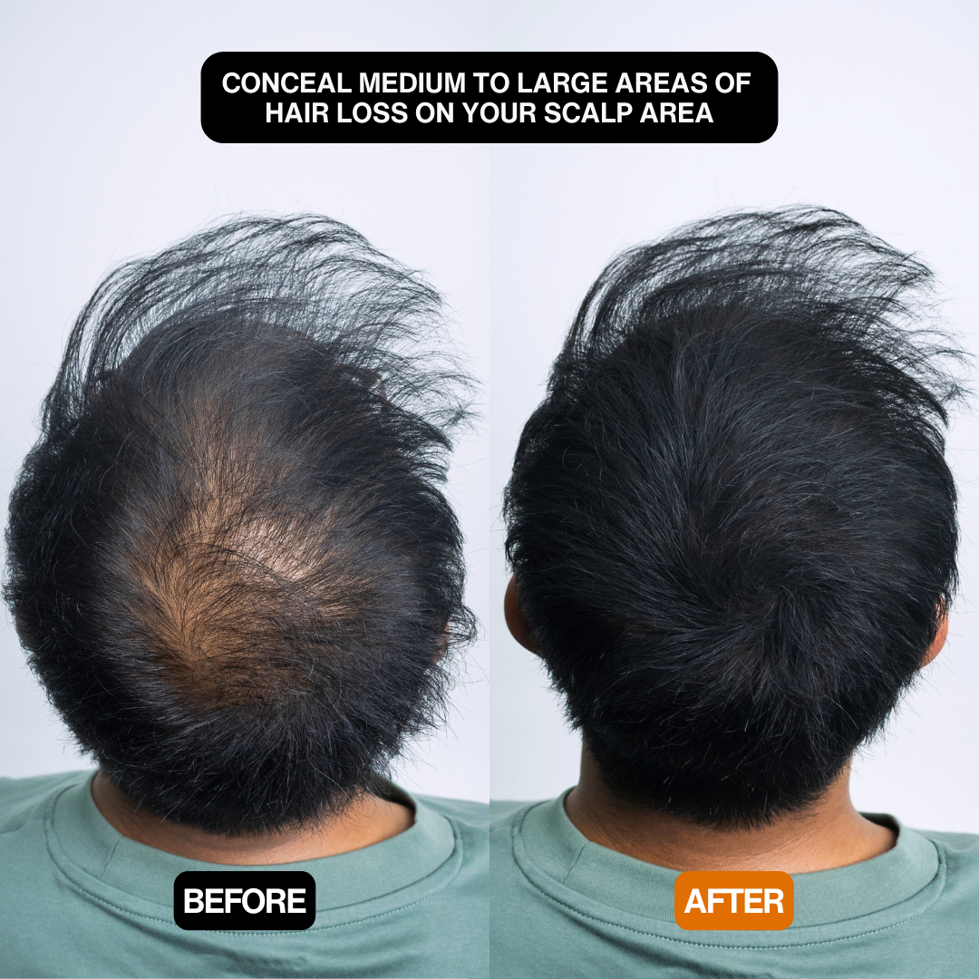 The No.1 Hair Loss Fix - Easy & Instant Results | Hair Filler Powder ...