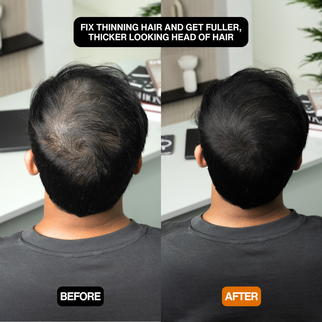 The No.1 Hair Loss Fix - Easy & Instant Results | Hair Filler Powder ...