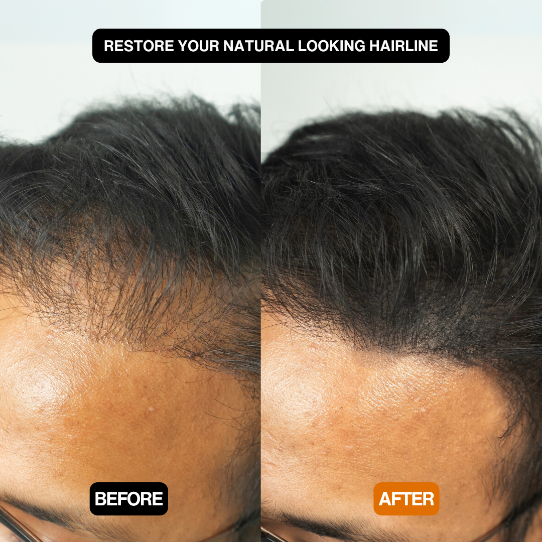 The No.1 Hair Loss Fix - Easy & Instant Results | Hair Filler Powder ...
