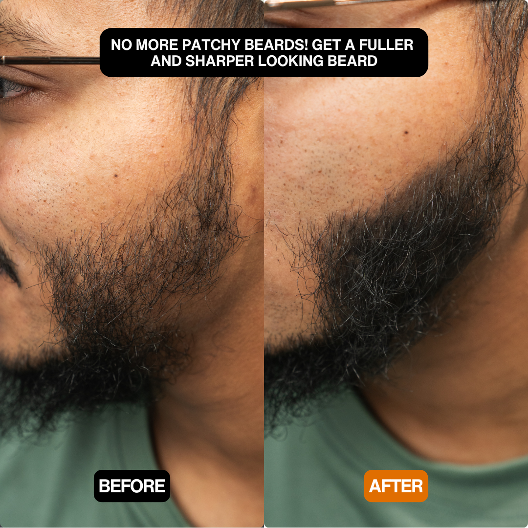 The No.1 Hair Loss Fix - Easy & Instant Results | Hair Filler Powder ...